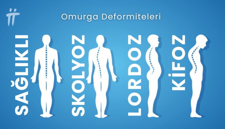 Askerlikten Muafiyet ve Ortopedik Hastalıklar Turan&Turan