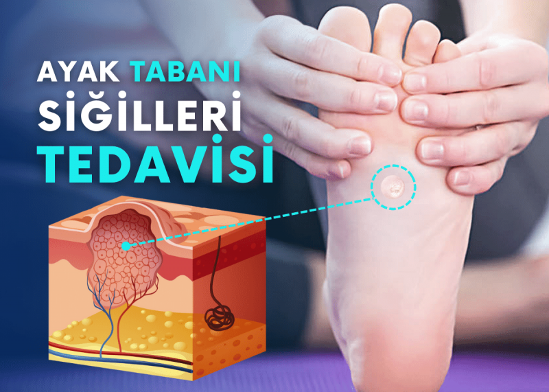 Çocuk Ayak Sağlığı - Turan&Turan