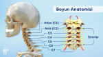 Boyun Düzleşmesi Nedir? Belirtileri, Teşhisi ve Tedavisi - Turan&Turan