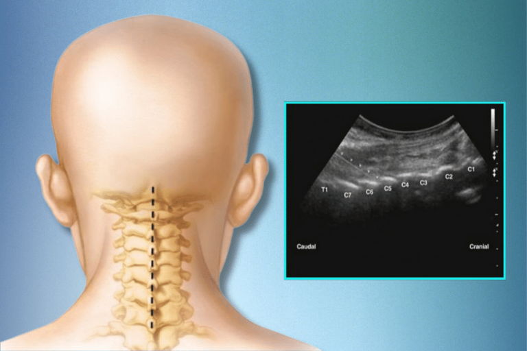 Ultrason Nedir? Ortopedide Ultrason Kullanımı Turan&Turan