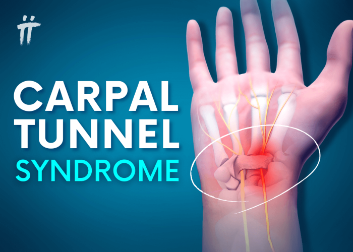 Carpal Tunnel Syndrome: Symptoms, Causes and Treatments Turan&Turan