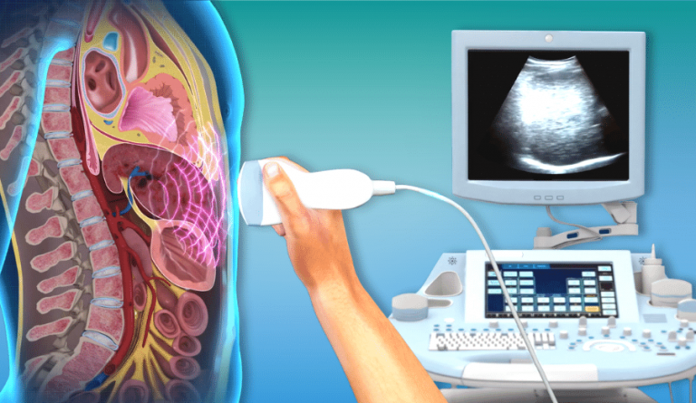 Ultrason Nedir? Ortopedide Ultrason Kullanımı Turan&Turan