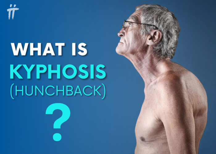 What is Kyphosis (Hunchback)? Treatment & Surgery Turan&Turan