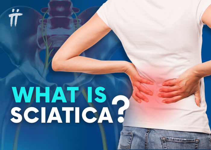 What is Sciatica? What is good for sciatica pain? Turan&Turan